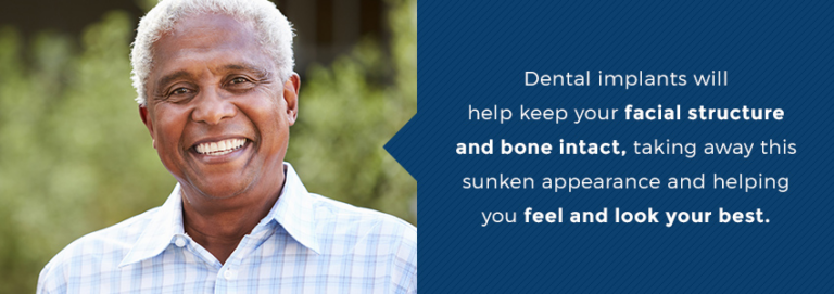 Dental Implants in Atlanta, GA | DentFirst Dental Care